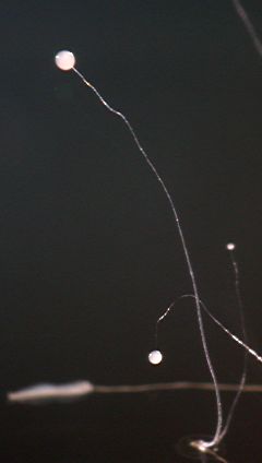 Fruiting bodies of cellular slime moulds