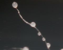 Fruiting bodies of cellular slime moulds